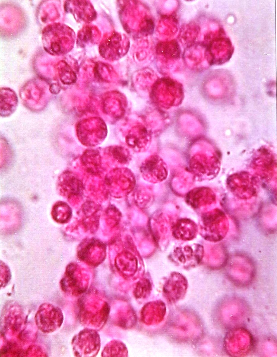 Parasitetesting