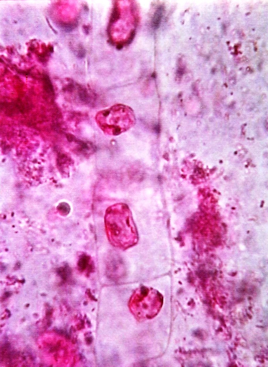 Parasitetesting